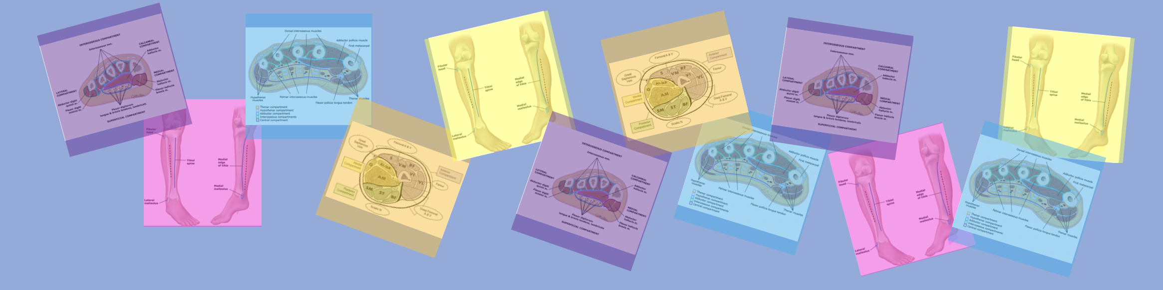Compartment Syndrome Atlanticcourses